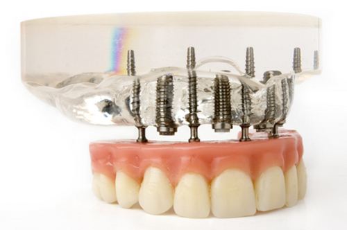 Dentures Jacksonville | Restorative Dentist | Dr. Ryan Johnson